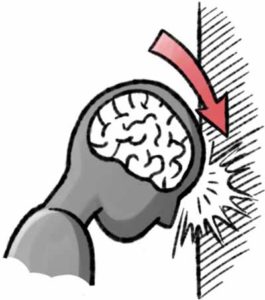 Concussion Protocol 101 Guide - ImPACT Applications | SG Web